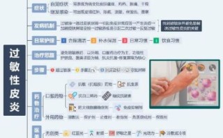 皮肤过敏怎么快速消除_皮肤过敏急救方法