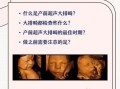大排畸什么时候做最好_最佳孕周是多少