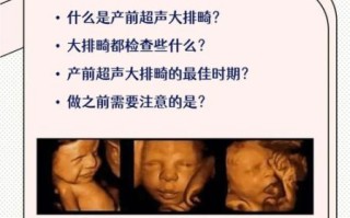 大排畸什么时候做最好_最佳孕周是多少
