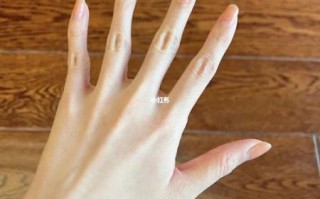 鸡爪手图片_鸡爪手怎么矫正 鸡爪手图片_鸡爪手怎么矫正