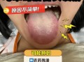 草莓舌苔是怎么回事_草莓舌苔是病吗