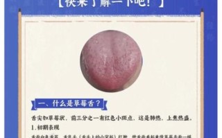 草莓舌是什么原因造成的_怎么判断是不是猩红热