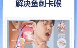 鱼刺卡喉咙怎么办_鱼刺卡喉咙自救法
