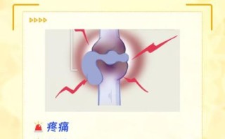 骨肉瘤好发部位有哪些_青少年长骨疼痛警惕