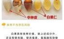 女人一天吃几颗白果好_白果一天最多吃多少粒