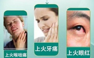 败火的药有哪些_败火的药怎么选