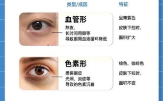 怎么消除黑眼圈_眼袋怎么消除