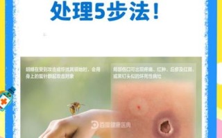 马蜂图片怎么区分种类_被马蜂蛰了怎么办