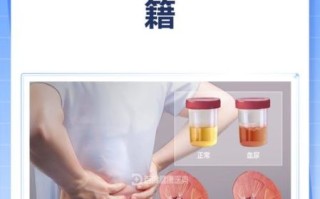 肾结石怎么治疗最好_肾结石最佳治疗方案