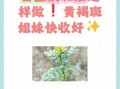 白芷祛斑怎么用_白芷祛斑具体方法