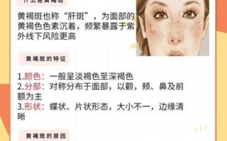 脸上色斑怎么去除_色斑图片对照哪种类型