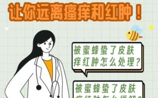 马蜂蛰了怎么快速消肿_马蜂蛰了止痒最有效的方法