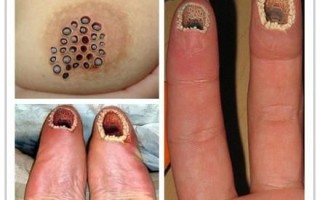 密集恐惧症图片测试图_怎么判断自己有没有密集恐惧症