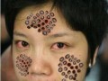 莲蓬手指恶心图是什么_为什么让人不适