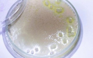 酸汤子中毒是什么菌_米酵菌酸中毒症状