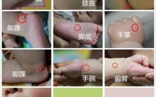 手足口病初期症状图片_如何判断是否感染