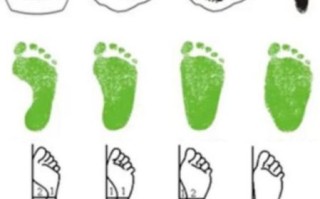 马蹄脚是什么_马蹄脚图片怎么判断