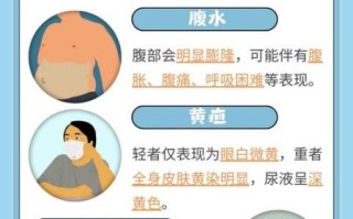 肝硬化能活多久_肝硬化晚期症状有哪些