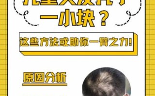 头顶秃了一小块怎么办_秃一小块会扩散吗