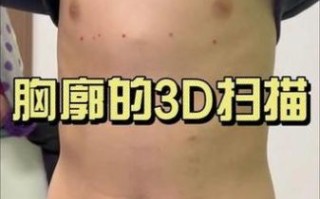 宝宝平躺胸骨正常图片_婴儿胸骨突出怎么办