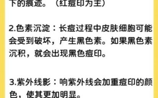 学生祛痘方法3天见效_学生祛痘最简单的方法