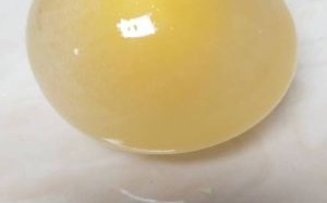 醋蛋液能消除肿瘤吗_真实案例揭秘