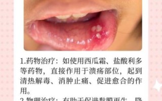 口腔溃疡几天能自愈_口腔溃疡多久能好