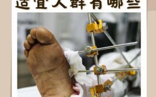 增高手术后遗症有哪些_增高手术风险大吗