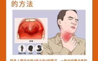 喉咙痛怎么办_快速缓解小妙招