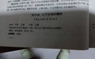鳝鱼血治疗面瘫的正确方法_鳝鱼血怎么用才有效