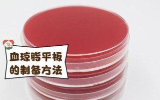 营养琼脂平板怎么保存_营养琼脂平板有效期多久