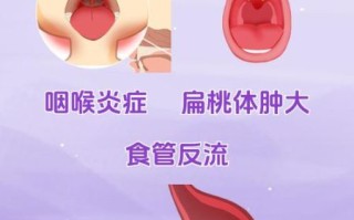 可以正常吞咽但有异物感_喉咙堵得慌怎么办