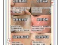 怎样美白淡斑效果最好_最有效的美白淡斑方法