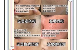 怎样美白淡斑效果最好_最有效的美白淡斑方法