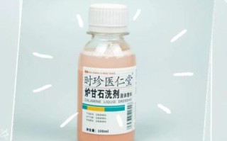 炉甘石擦完后多久清洗_炉甘石洗剂停留时间