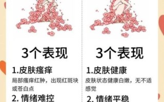 荨麻疹快速止痒小妙招_荨麻疹怎么止痒最快最有效