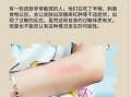 辣椒素会烧伤皮肤吗_辣椒素对皮肤伤害程度