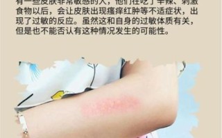 辣椒素会烧伤皮肤吗_辣椒素对皮肤伤害程度