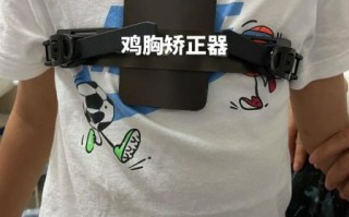 鸡胸脯怎么矫正_鸡胸脯矫正方法有哪些
