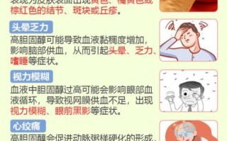 胆固醇高是什么原因_胆固醇高怎么治疗 胆固醇高是什么原因_胆固醇高怎么治疗