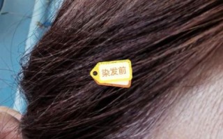 长期吃桑葚白头发能黑吗_桑葚黑发真相