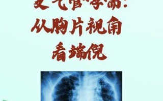 哮喘最好的自愈方法_哮喘能自己好吗