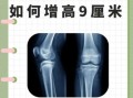 骨骺线闭合还能长高吗_骨骺线闭合增高9厘米是真的吗