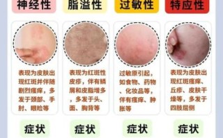 皮肤病图片对照大全_如何快速识别常见皮肤病 皮肤病图片对照大全_如何快速识别常见皮肤病