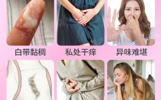 豆腐渣白带怎么治疗_豆腐渣白带用什么药