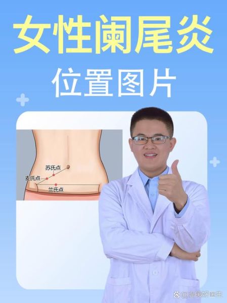 女性阑尾炎早期症状有哪些_女性阑尾炎和月经痛区别-第1张图片-山城妙识