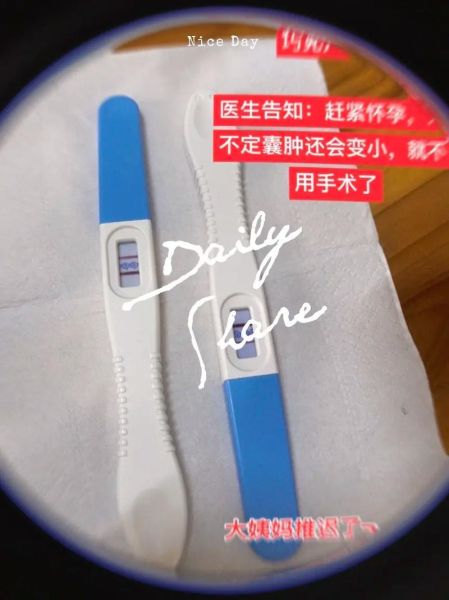 巧克力囊肿手术后能怀孕吗_术后多久可以备孕-第2张图片-山城妙识 巧克力囊肿手术后能怀孕吗_术后多久可以备孕-第2张图片-山城妙识