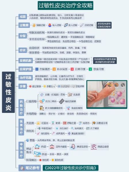 皮肤过敏怎么快速消除_皮肤过敏急救方法-第1张图片-山城妙识