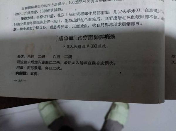 鳝鱼血治面瘫有效吗_鳝鱼血治面瘫偏方怎么用-第1张图片-山城妙识 鳝鱼血治面瘫有效吗_鳝鱼血治面瘫偏方怎么用-第1张图片-山城妙识