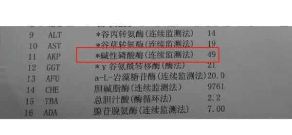 碱性磷酸酶偏高怎么办_碱性磷酸酶偏高吃什么-第1张图片-山城妙识